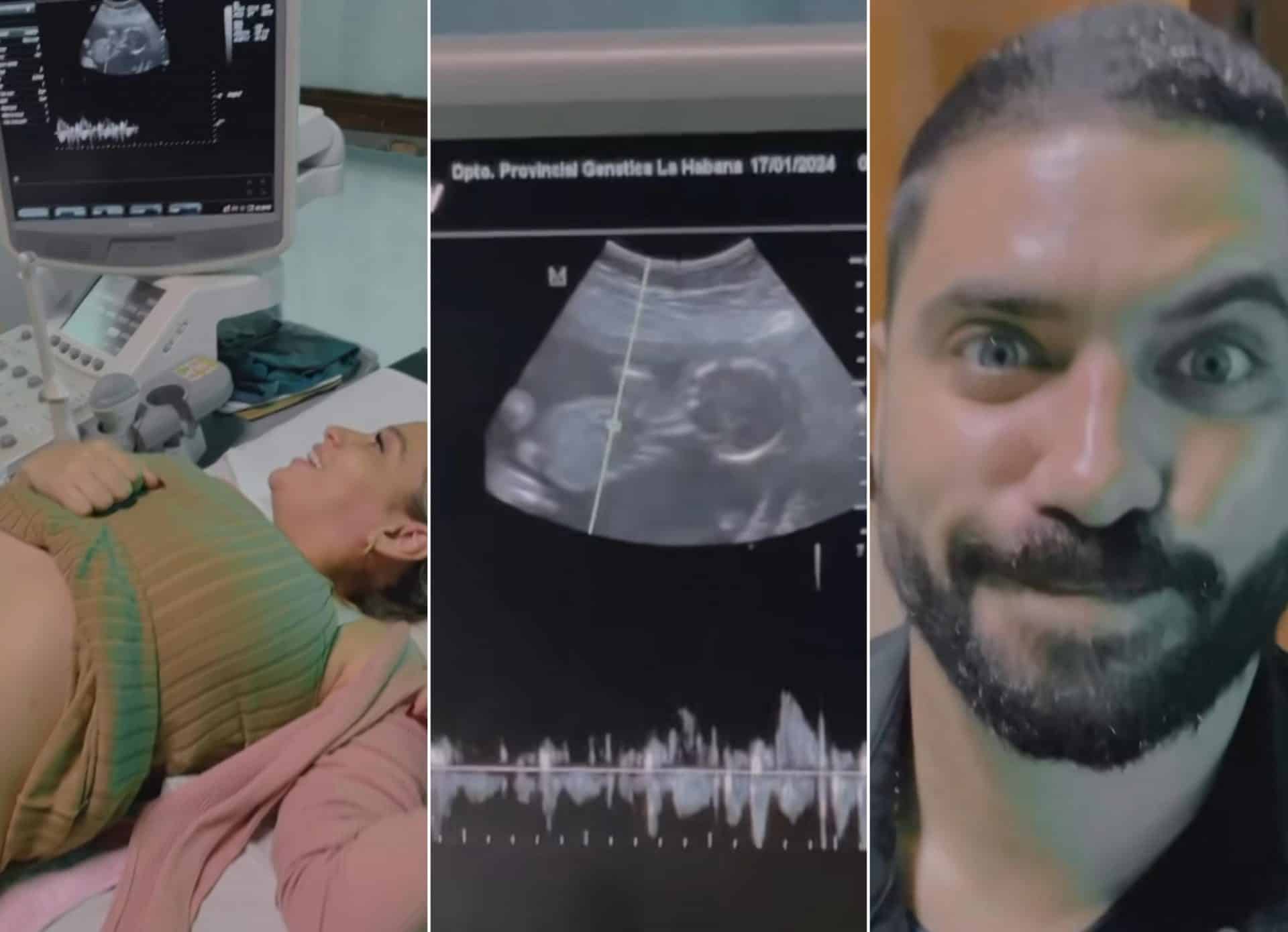 Alejandro Cuervo muestra los primeros latidos de su bebé, el hermanito ...