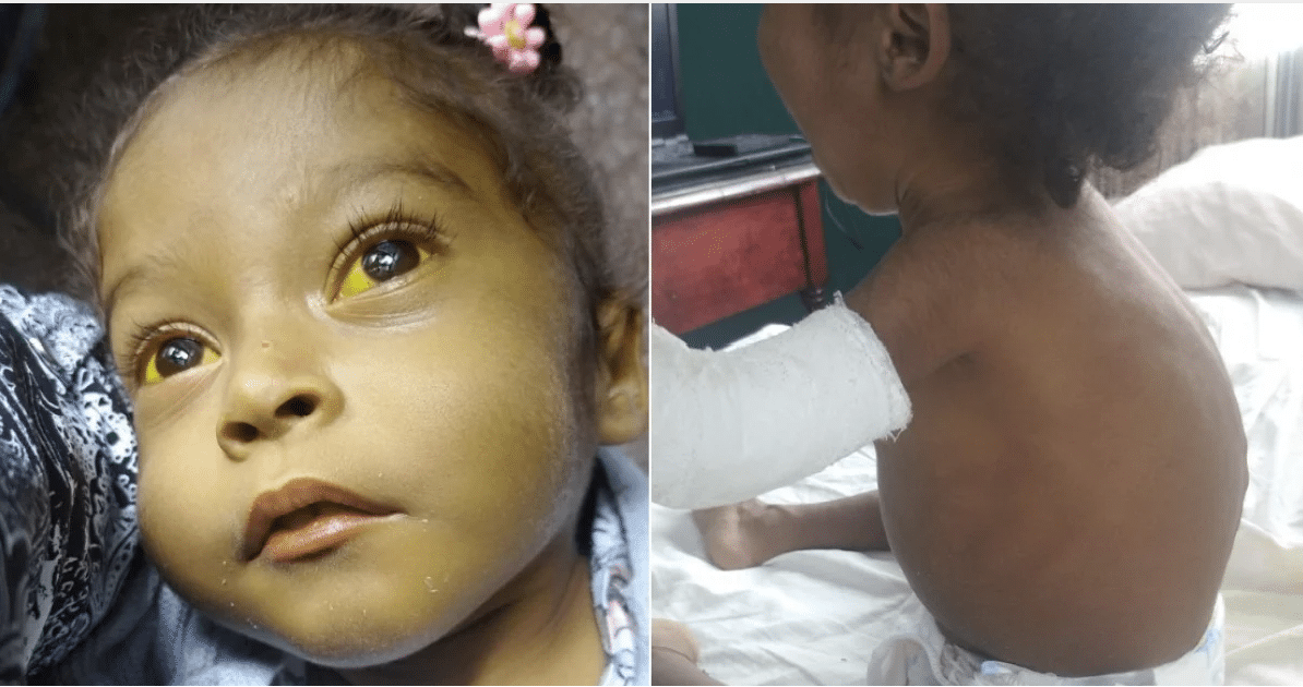 Caso de niña cubana Amanda llega a la prensa española - Cuballama Noticias