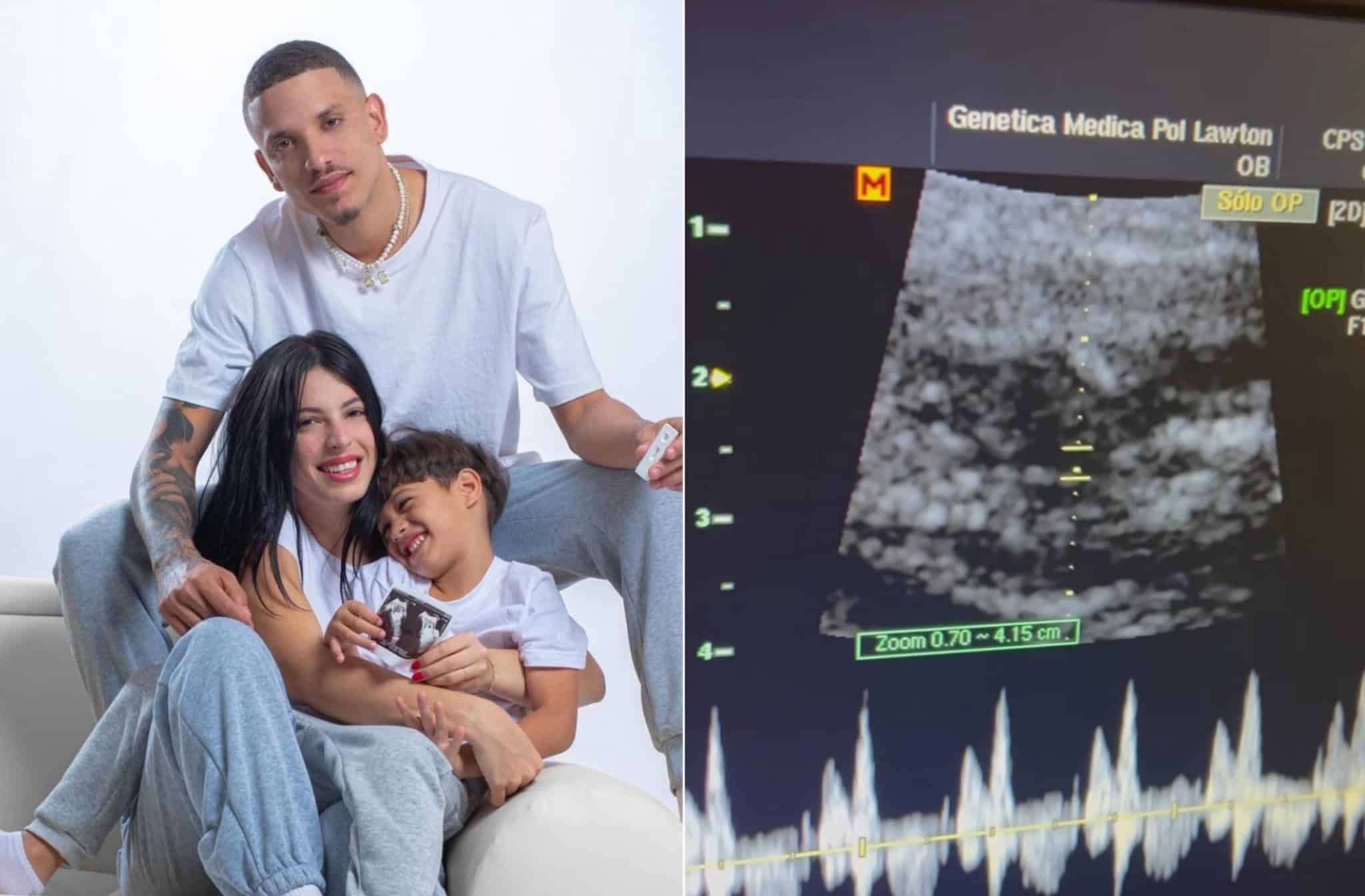 Bebeshito comparte la ecografía de su bebé: “Idéntico a mí desde antes ...