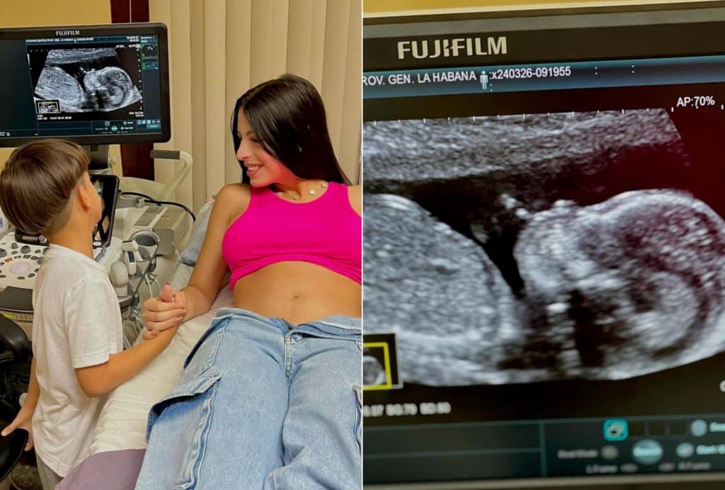 Bebeshito y Rachel ven el rostro de su hija por primera vez: “Estoy en ...