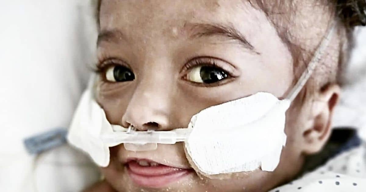 La foto que demuestra el cambio enorme que ha dado la niña cubana ...