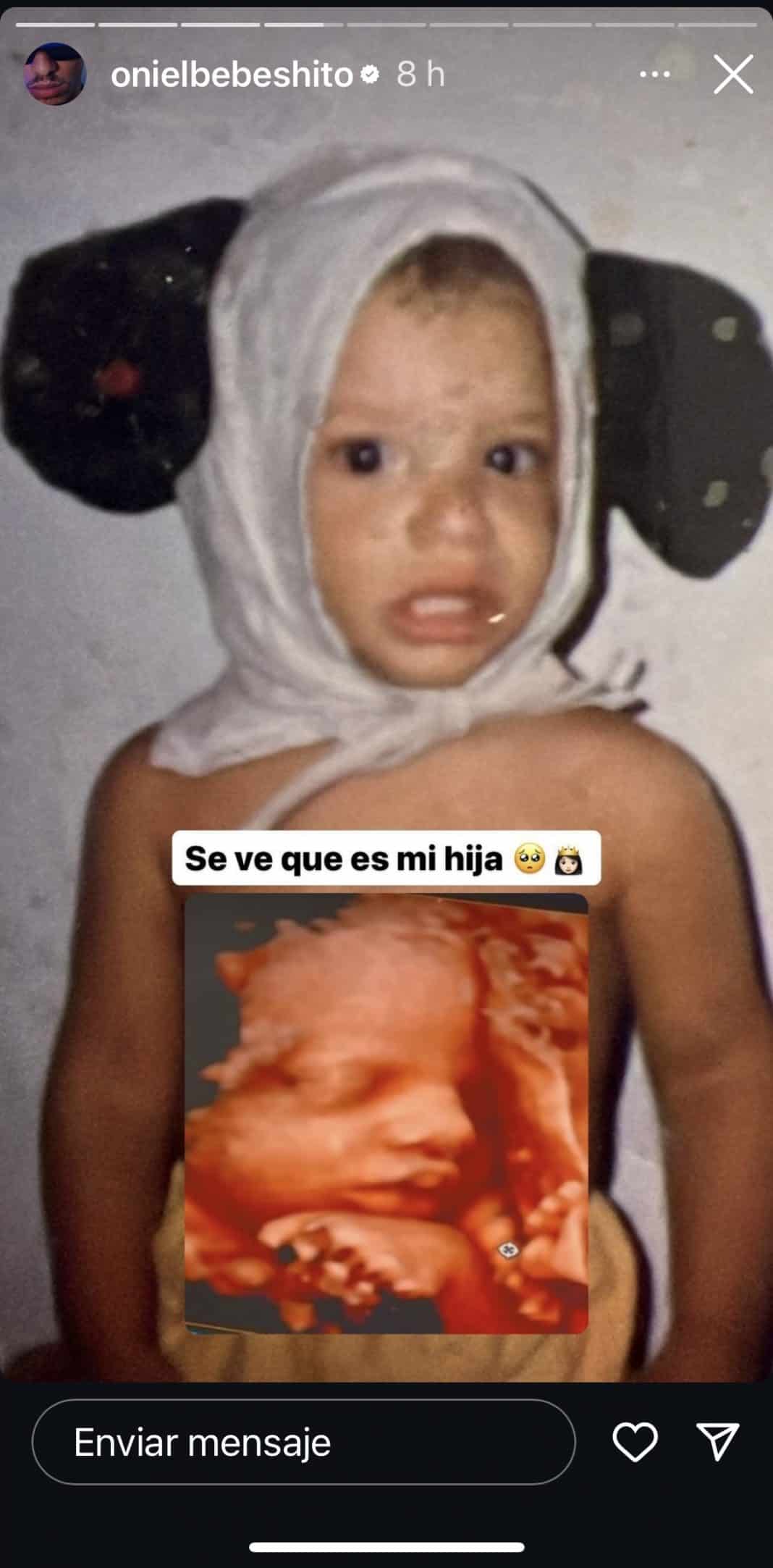 Rachel Arderi ve el rostro de su bebé por primera vez: así luce Mía, la ...