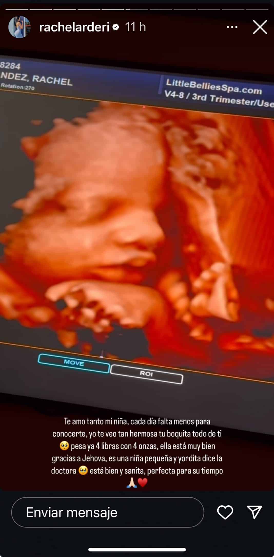 Rachel Arderi ve el rostro de su bebé por primera vez: así luce Mía, la ...