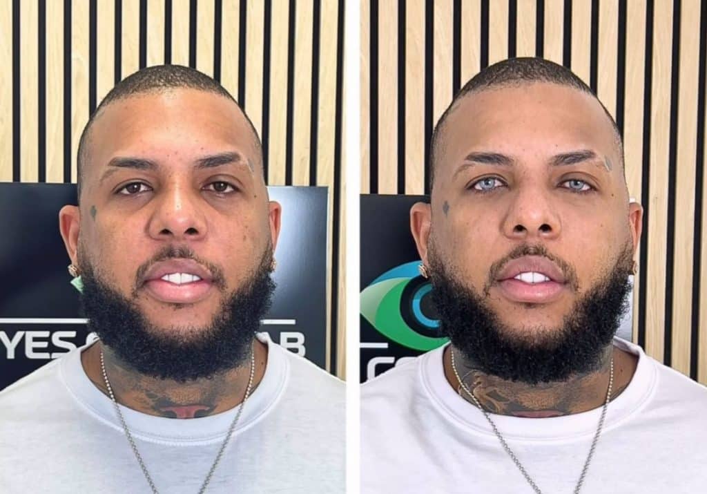 Wow Popy, otro reguetonero cubano que se cambia el color de los ojos en ...