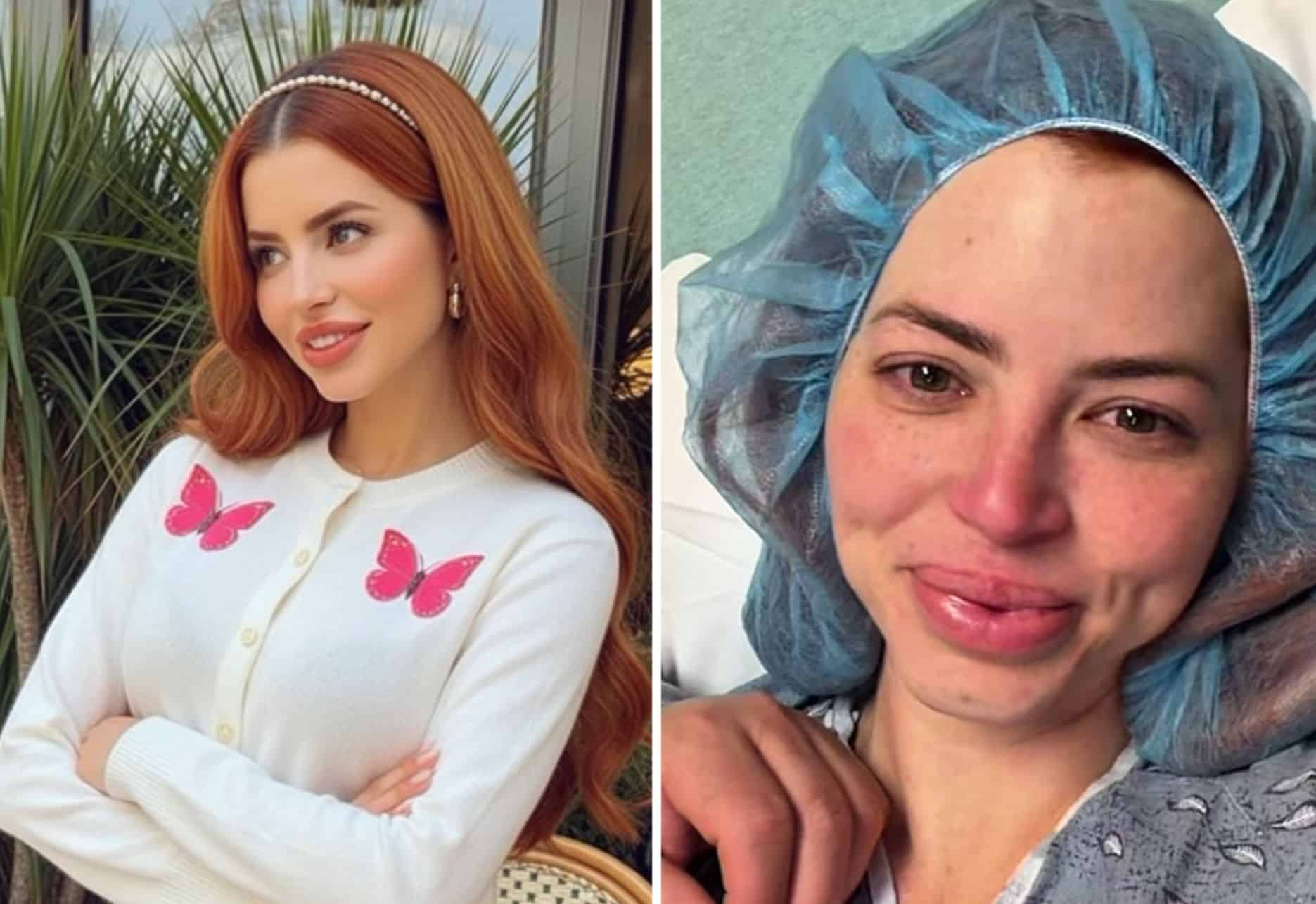 Influencer cubana La Mariposa se somete a una histerectomía: “Retiraron ...